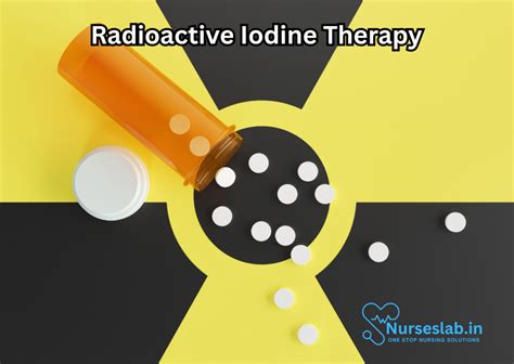 Radioactive Iodine Therapy