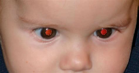 Eliminar Ojos Rojos Tutorial Monsters Diseño Web Photoshop