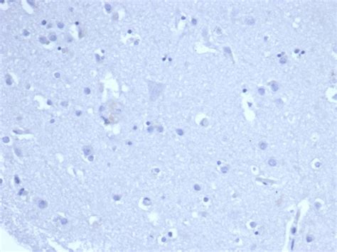 Ki 67 Recombinant Monoclonal Antibody Rmki67 6615 4288 Msm25 P1
