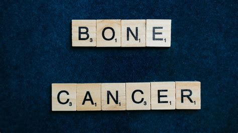Bone Cancer Symptoms Diagnosis And Treatment Health Hindustan Times