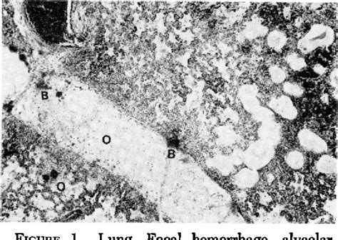 Figure 1 From Actinobacillus Suis Infections In Alberta Swine 1973 75