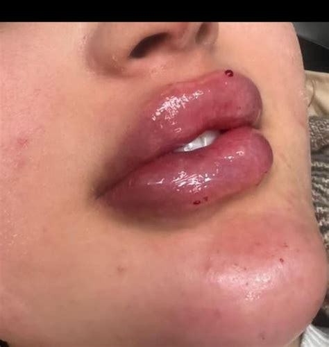 خدمات ژل ،بوتاکس ،جوانسازخدمات آرایشگری و زیباییتهران، صادقیهدیوار