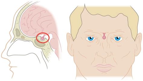 The Pituitary Gland Note Reproduced With Permission From Harris Ag