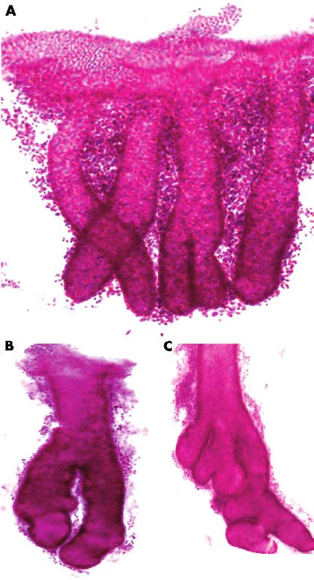 Microdissected Crypts From Normal Colonic Mucosae And Adenomas A