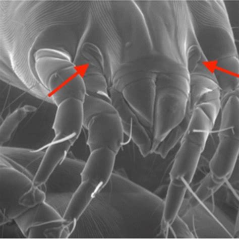 Fecal Particles Seen Under A A Light Microscope And B An Electron
