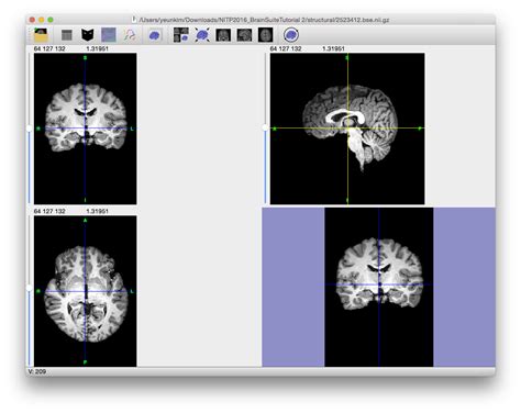 Nonuniformity Correction · Brainsuite