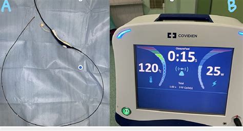 A Radial Probe Of The Rfa B Monitor Showing The Temperature Achieved