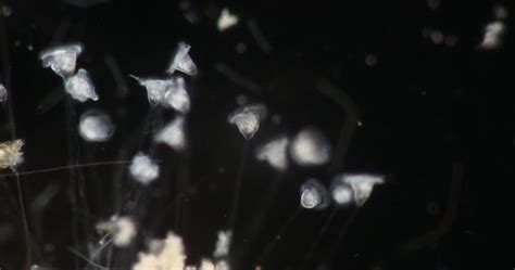 Vorticella Bilder Bläddra Bland 333 Stockfoton Vektorer Och Videor