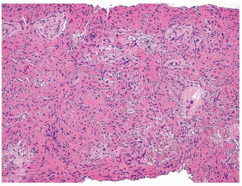 Prostate Basicmedical Key