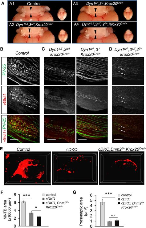 Different Combinations Of Tissue Specific Gene Deletions In Dynamin Download Scientific Diagram