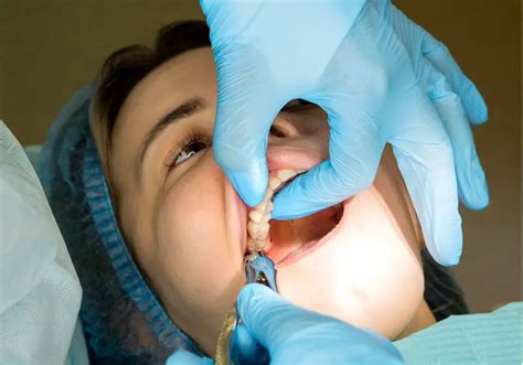 Reduce Your Risk Of Infection After Tooth Extraction Tips And Tricks