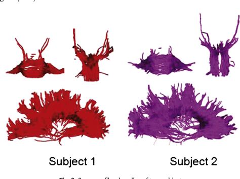 Figure 1 From Tractography Segmentation Using A Hierarchical Dirichlet