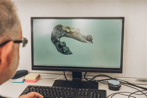 La Stampa 3d In Odontoiatria Bruno Scarfò