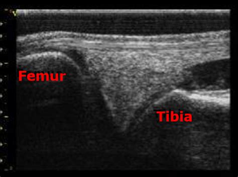 Joint Imaging Diagram Quizlet