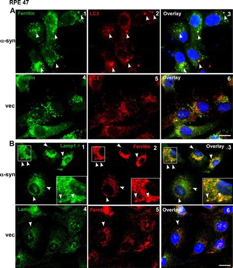 Ferritin Co Localizes With Lc3 And Lamp1 In α Syn Over Expressing