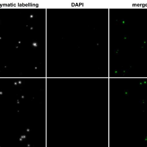 The Effect Of The Fixation Protocols On The Dapi Staining Of
