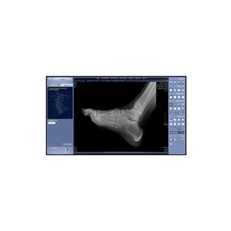 Rayence Xmaru Software Associated X Ray Imaging Corporation