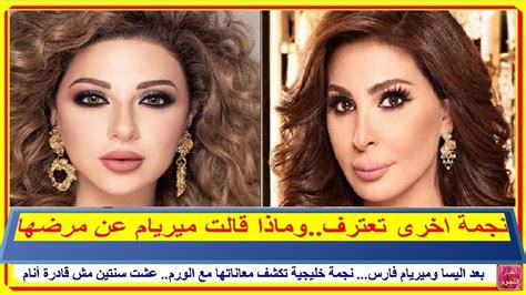 بعد اليسا وميريام فارسنجمة خليجية تكشف معاناتها مع الورمعشت سنتين