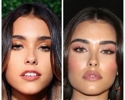 Madison Beer Plastic Surgery Plastic Surgery Face Plastic Surgery
