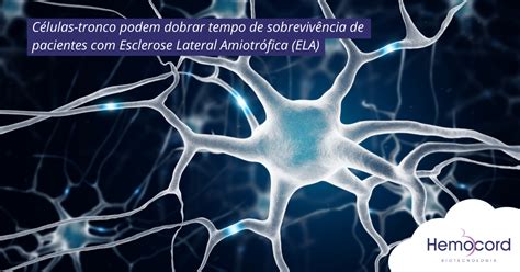 Células Tronco Podem Dobrar Tempo De Sobrevivência De Pacientes Com
