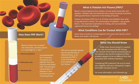 Platelet Rich Plasma Prp A Biologic Solution “heal Thy Self