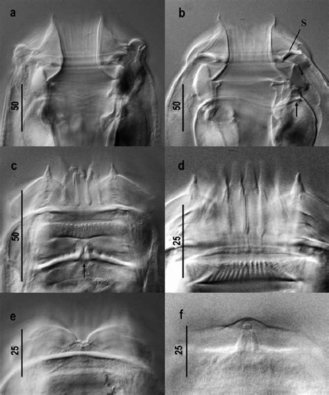 Coronocyclus Labiatus A Buccal Capsule Dorsoventral View B