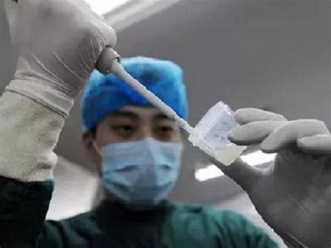 在国内三甲医院做男性精子dna碎片检查要多少钱？ 名医在线