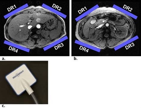 Driver Position Of The Four Soft Flexible Passive Drivers Used For Download Scientific Diagram