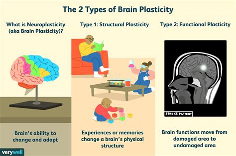 These 5 Simple Brain Exercises Can Significantly Improve Your Memory