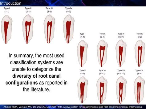 New Root Canal Classification System Pptx