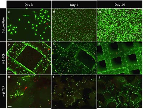 Bone Regeneration Is An Advancing Field Of Research Ossiform W E Print Bone