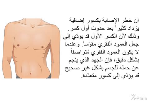 كسور الفقرات الانضغاطية