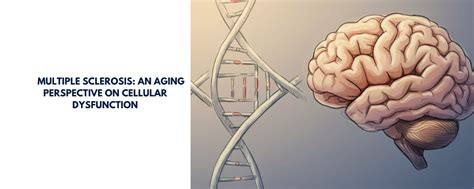 Multiple Sclerosis An Aging Perspective On Cellular Dysfunction Hereat