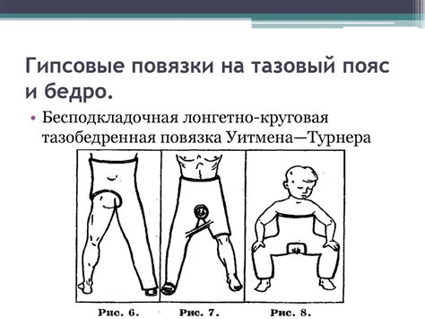 Основы десмургии - презентация онлайн
