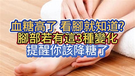血糖高了，看腳就知道腳部若有這3種變化，提醒你該降糖了 Youtube