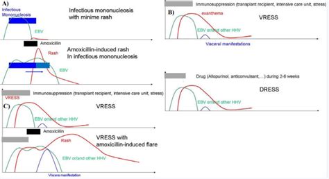 Severe Amoxicillin Induced Rash And Ebv Reactivation Dress Or Vress