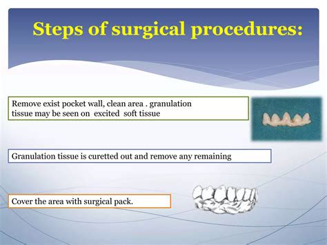 Gingivectomy Pptx