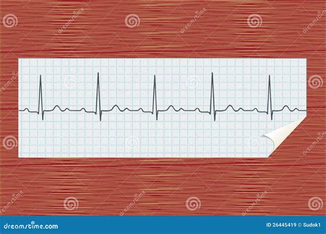 Electrocardiogram Paper With Normal Ecg Cartoon Vector Cartoondealer