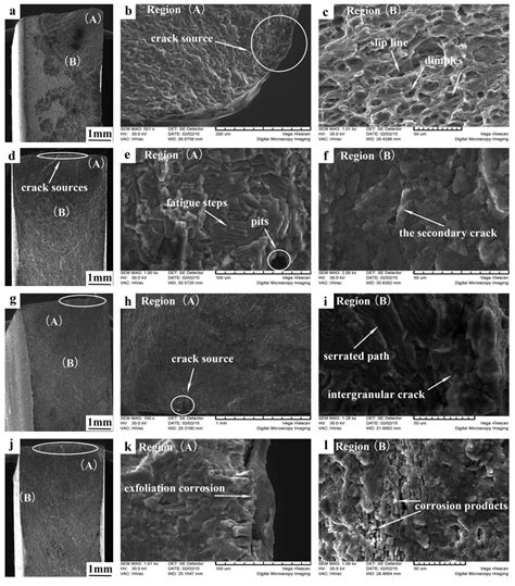 Sem Micrographs Of The Fatigue Fracture Surface In The Upper Area Of