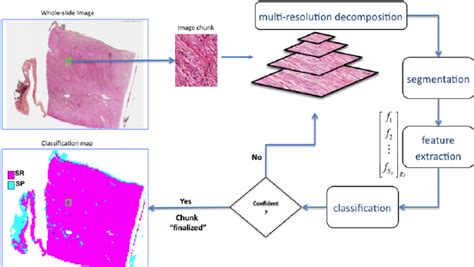 Neuroblastoma Classification Nc Workflow Download Scientific Diagram