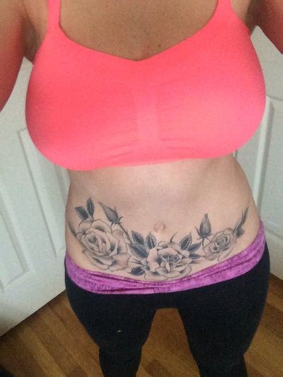 34 Ddd Breast Implants
