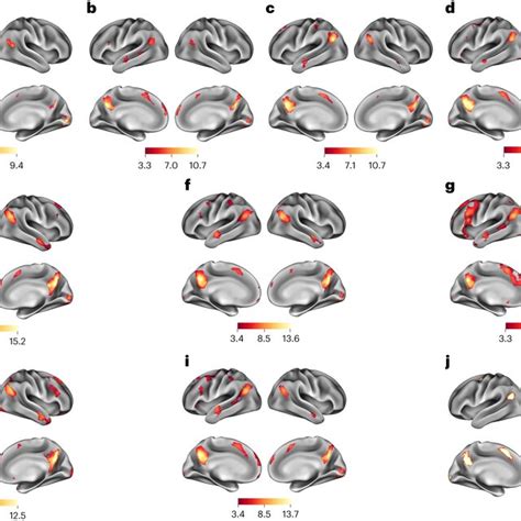 Results Of Whole Brain Univariate Analyses Ai Statistical Parametric