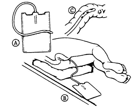 Section Iv Nursing Implications By Body Systems Of A Postoperative Patient