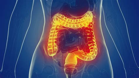 Strictureplasty Background Indications Contraindications