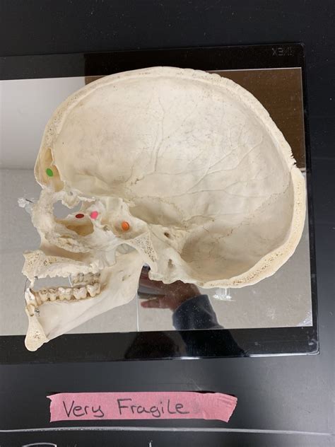 Sinuses Of Skull Diagram Quizlet
