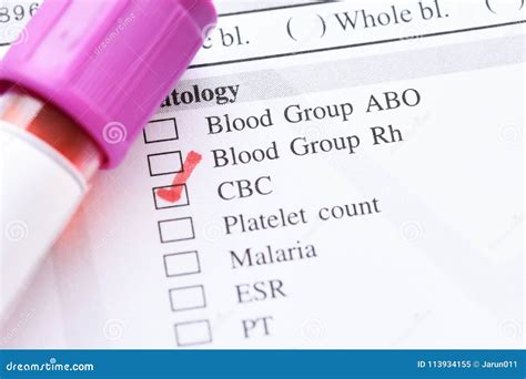 Blood For CBC Test Stock Image Image Of Research Health