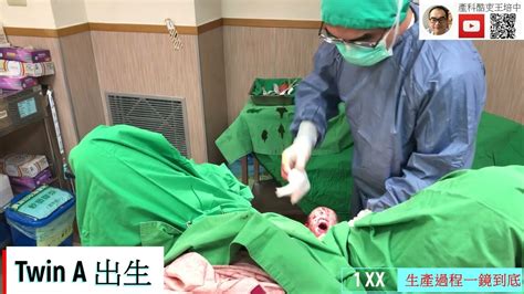 生產實拍 雙胞胎陰道分娩 2022 無碼血腥版 Youtube