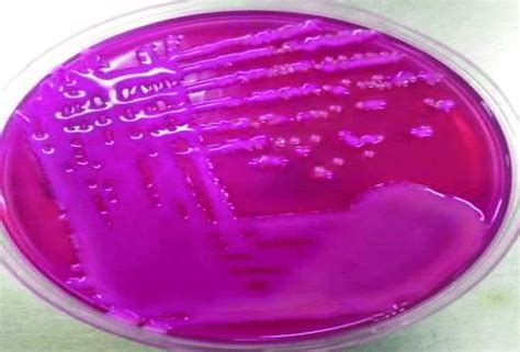 Staphylococcus Aureus On Macconkey Agar