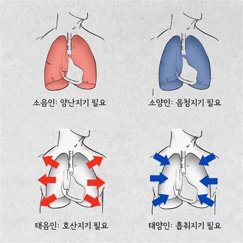 기관지 확장증 치료법