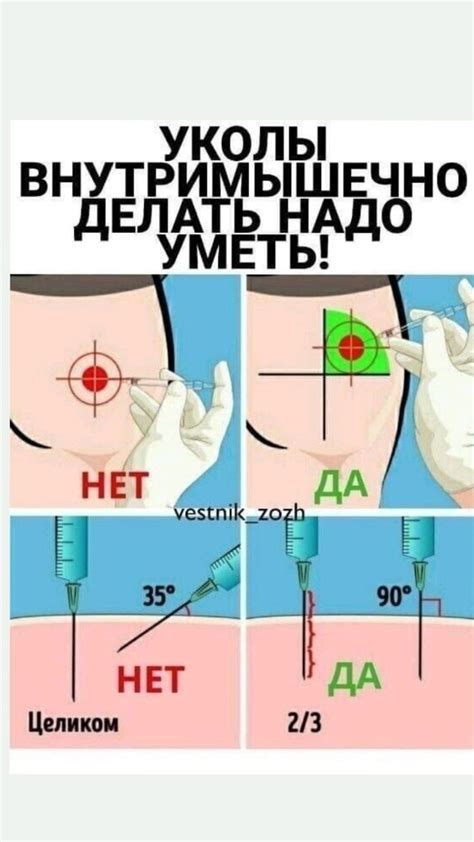 Как правильно надо делать уколы внутримышечно | Gezond